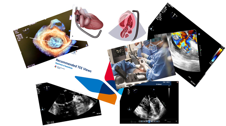 Recommended TEE Views For Non Cardiac Surgery